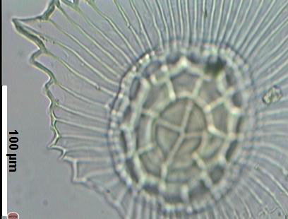 Qué son las plantas epífitas, parásitas, hongos simbiontes y su impacto ...